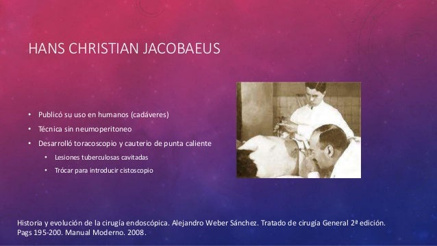 Historia de la laparoscopia