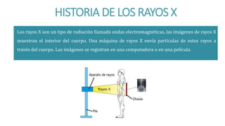 Historia de los rayos X | PPTX