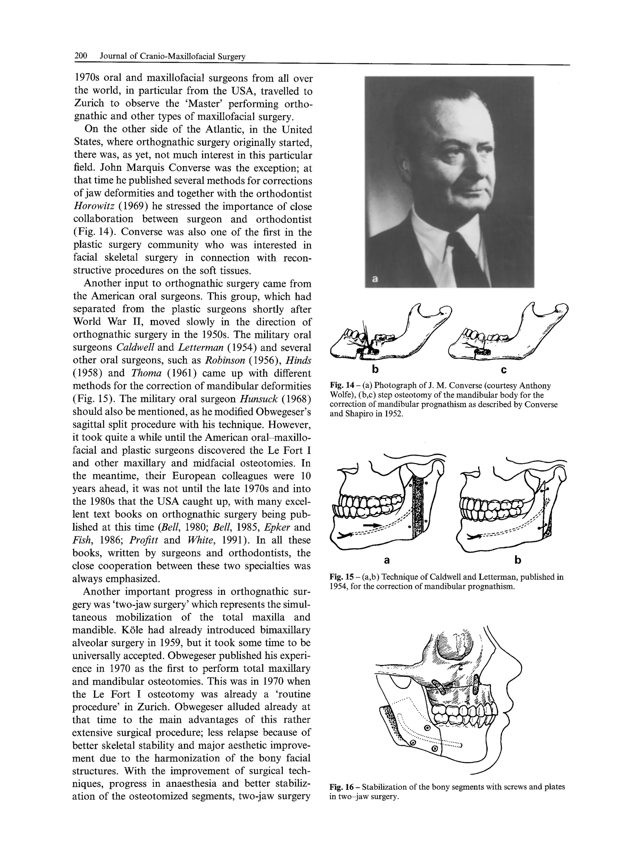 Historical development of orthognathic surgery | PDF