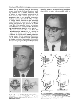 Historical development of orthognathic surgery | PDF
