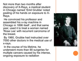 History of Radiotherapy | PPTX