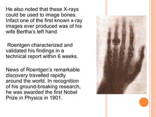 History of Radiotherapy | PPTX