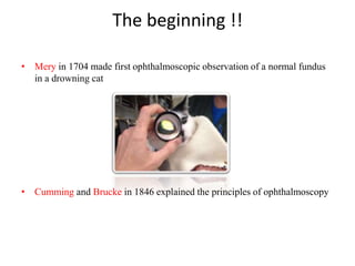 History of Indirect Ophthalmoscope | PPTX