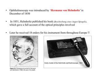 History of Indirect Ophthalmoscope | PPTX