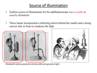 History of Indirect Ophthalmoscope | PPTX