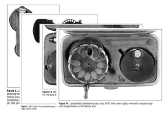 History of Indirect Ophthalmoscope | PPTX