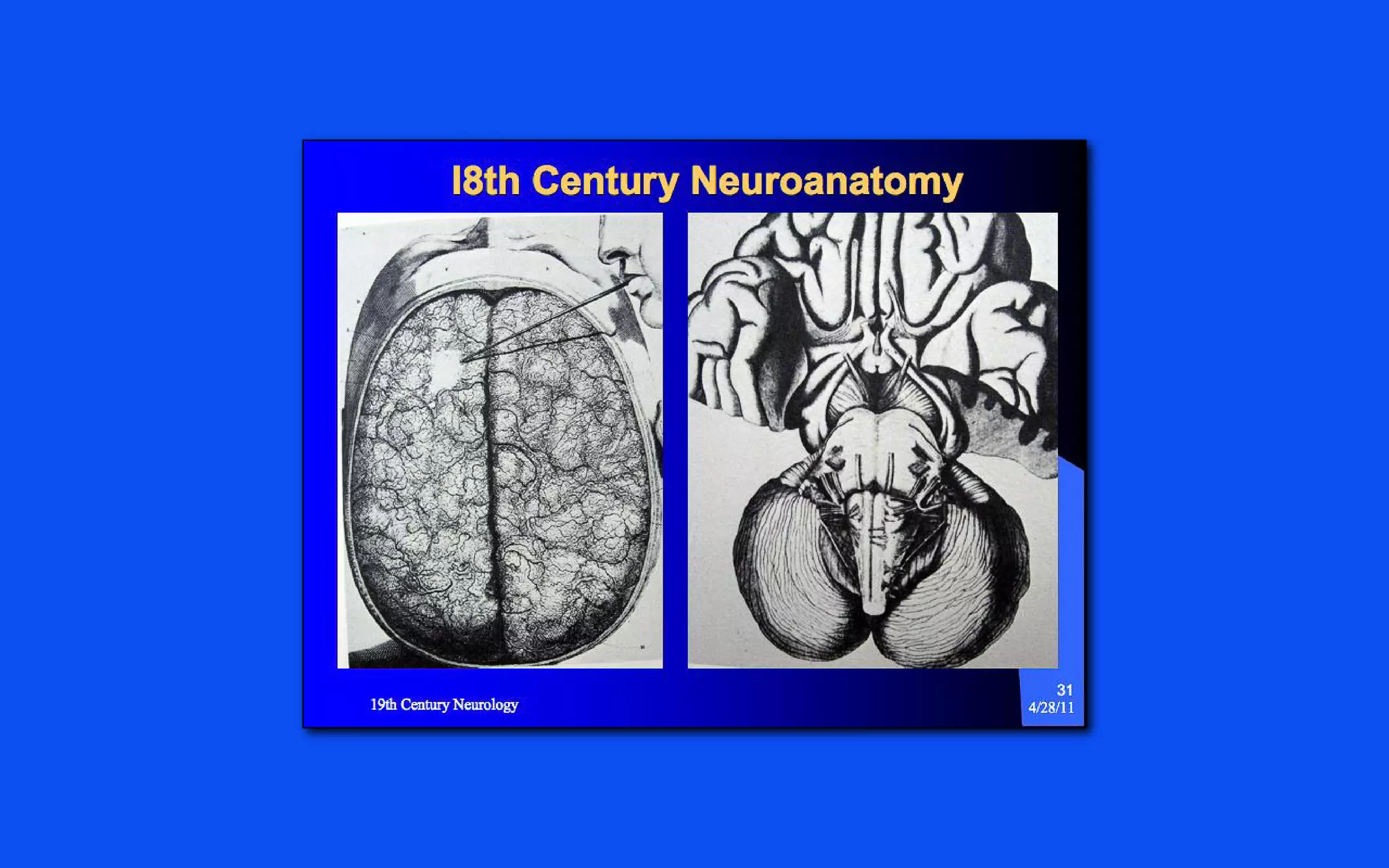 History of-Neurology | PDF