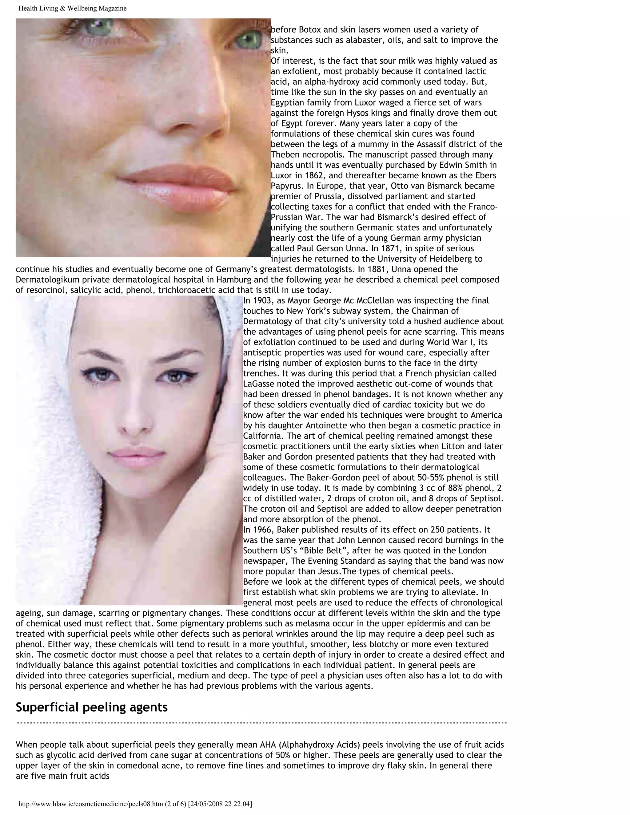 History Of Peels | PDF