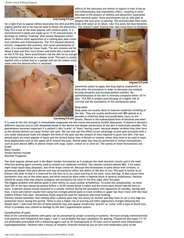 History Of Peels | PDF | Skin and Dermatology | Diseases and Conditions
