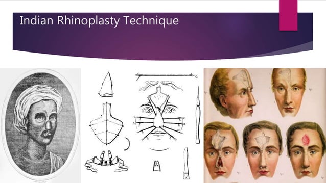 History and evolution of surgery | PPTX | First Aid | Injuries