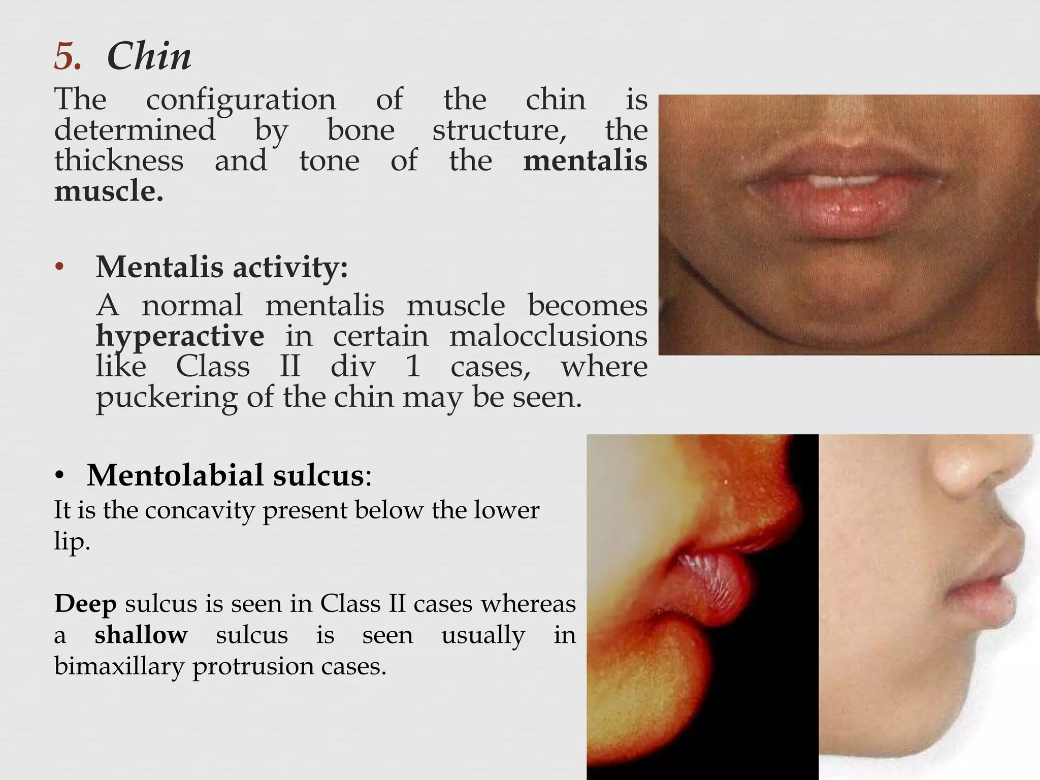 Orthodontic Case History and Examination | PPTX
