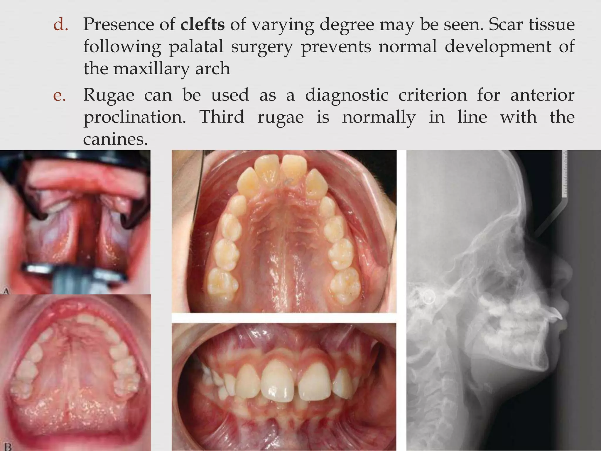 Orthodontic Case History and Examination | PPTX