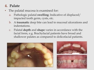 Orthodontic Case History and Examination | PPTX