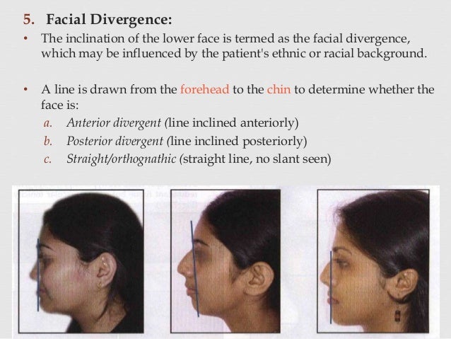 Orthodontic Case History and Examination