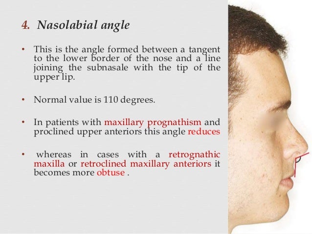 Orthodontic Case History and Examination