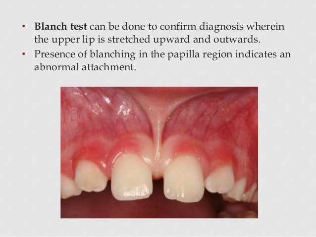 Orthodontic Case History and Examination