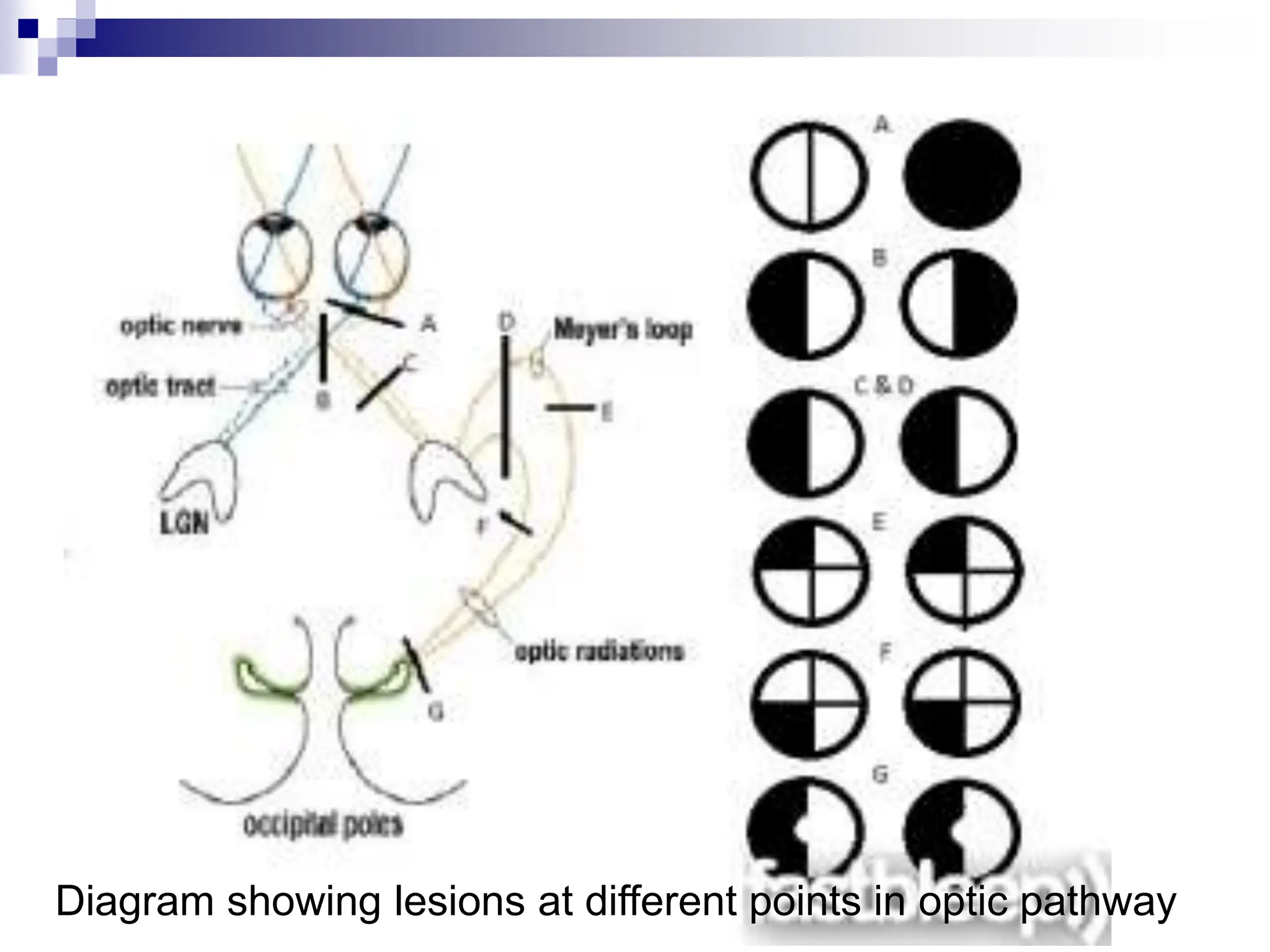 History and examination of nervous system- Part II.ppt