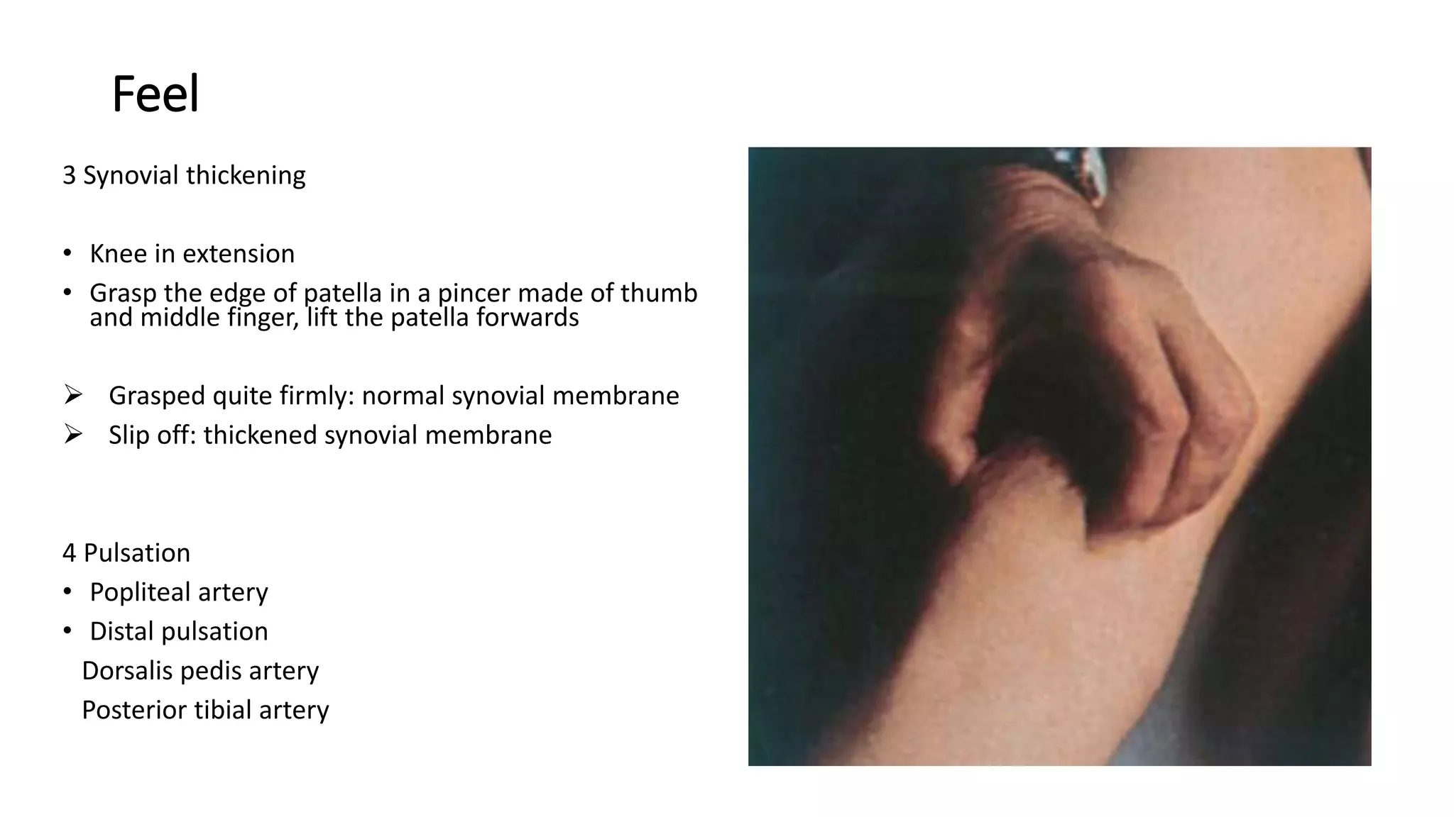 History and examintion of knee joint slideshare | PPTX