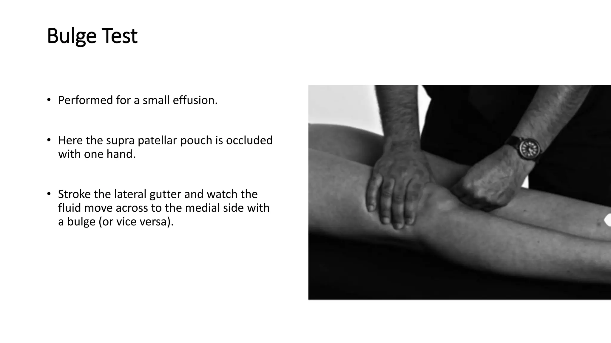 History and examintion of knee joint slideshare | PPTX
