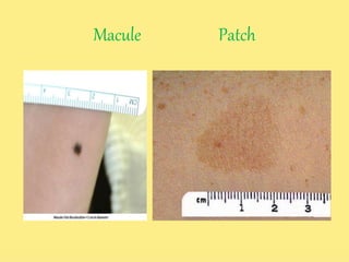 History and physical assessment of integumentary system | PPTX