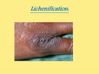 History and physical assessment of integumentary system | PPTX