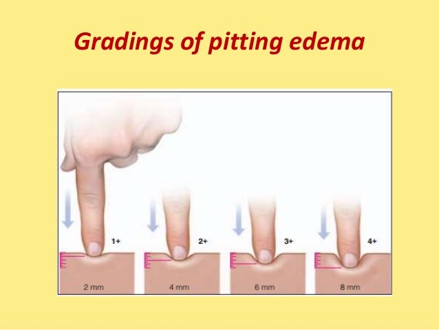 History and physical assessment of integumentary system