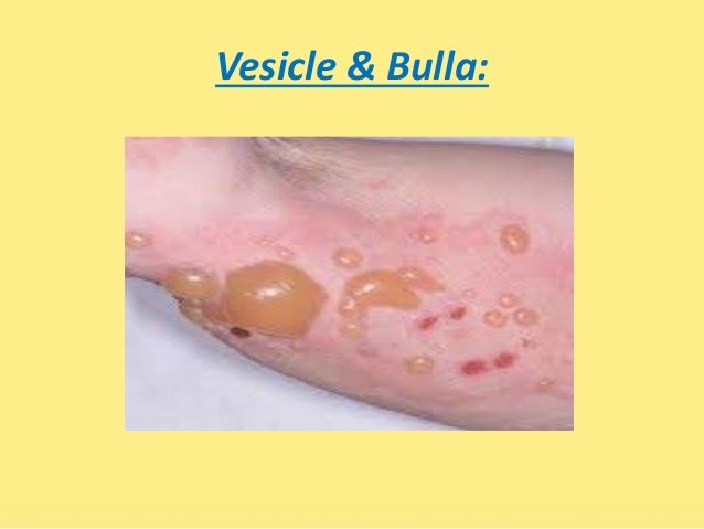 History and physical assessment of integumentary system