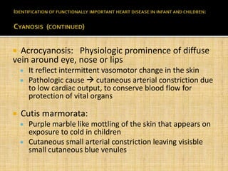 History and physical examination of congenital heart disease | PPTX