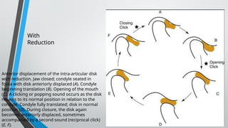 History,CE & Radiology-of-TM-Joint. presenpptx | PPTX