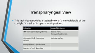 History,CE & Radiology-of-TM-Joint. presenpptx | PPTX