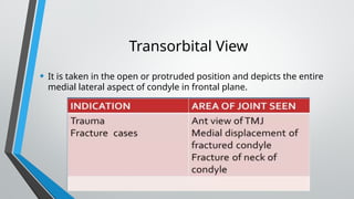 History,CE & Radiology-of-TM-Joint. presenpptx | PPTX