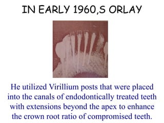 History & Classification of Implants.pdf