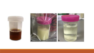 History collection of a patient with renal disorder.pptx
