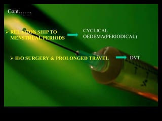 History & examination of edema | PPTX