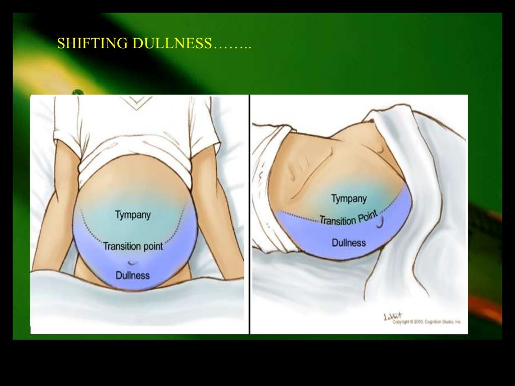 History & examination of edema