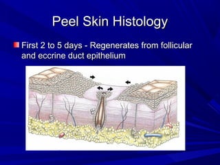 History facial chemical-peels | PPT