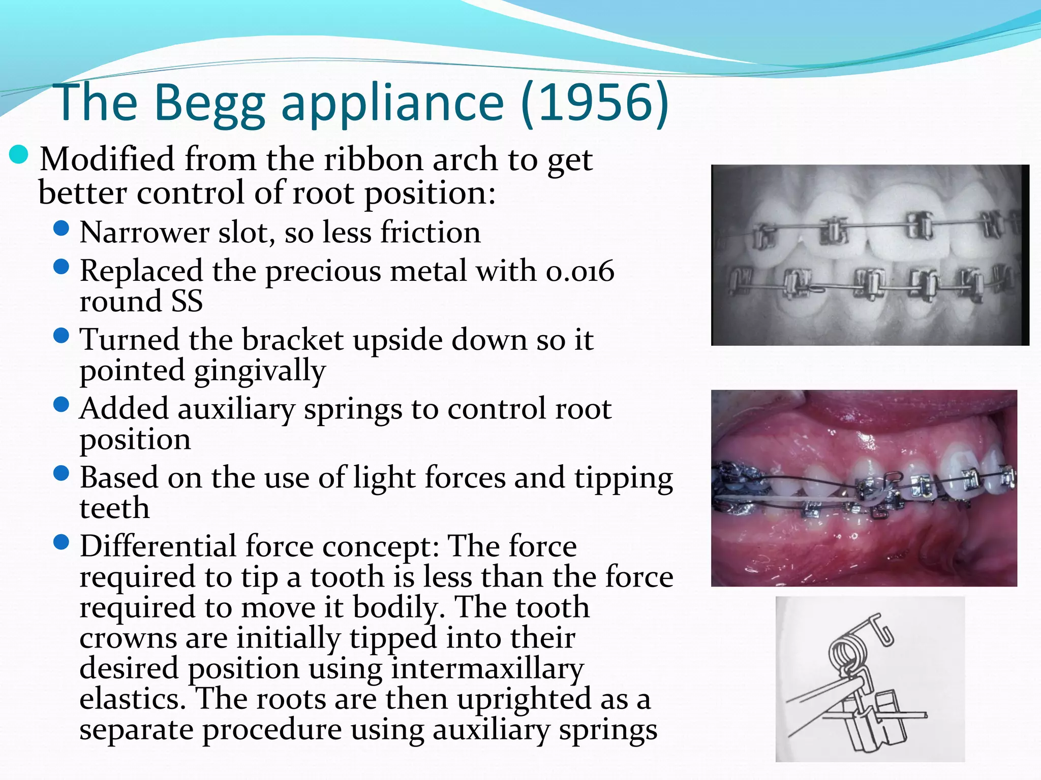 History fixed appliances | PPT