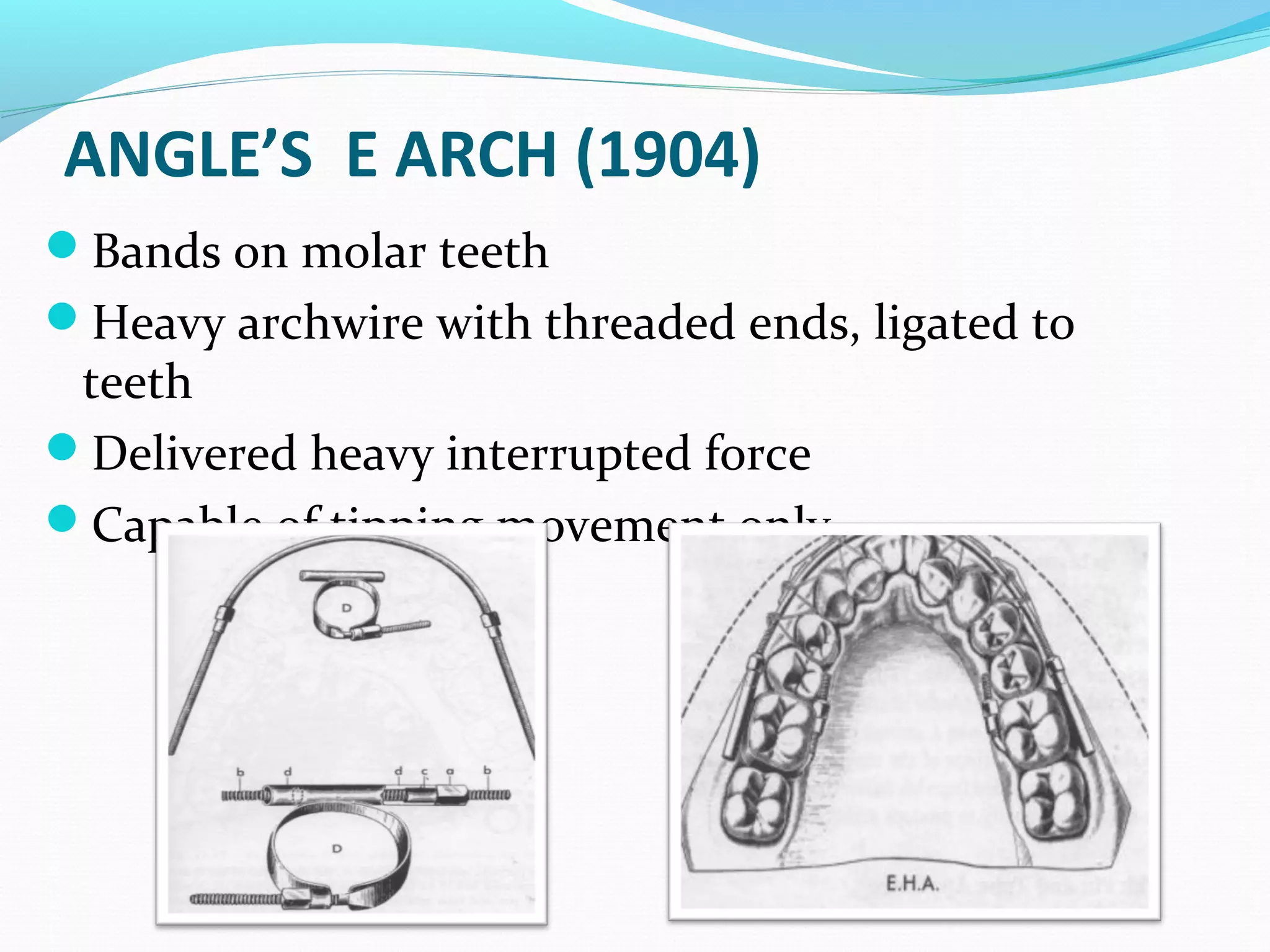 History fixed appliances | PPT