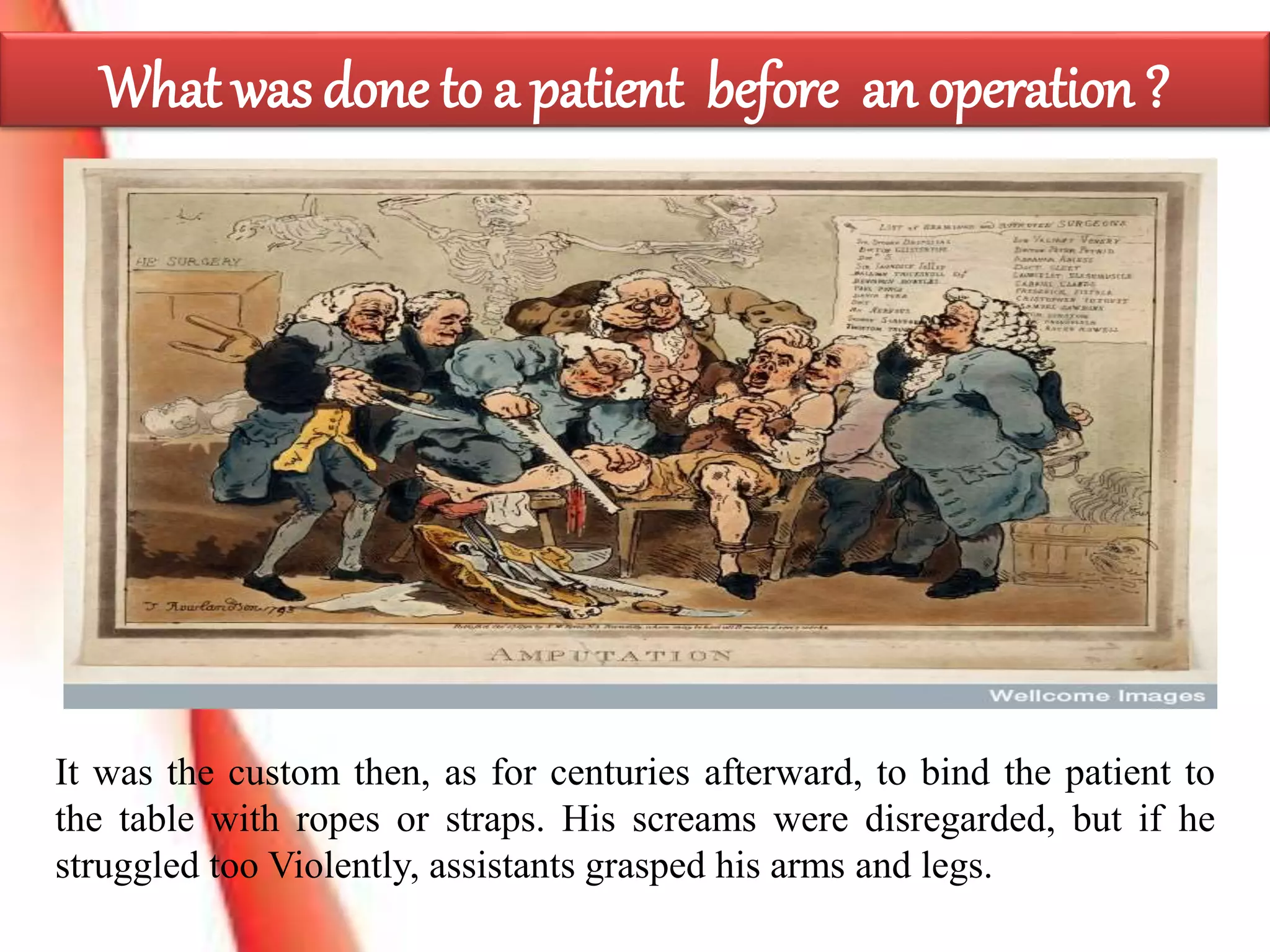 History of anaesthesia | PPTX