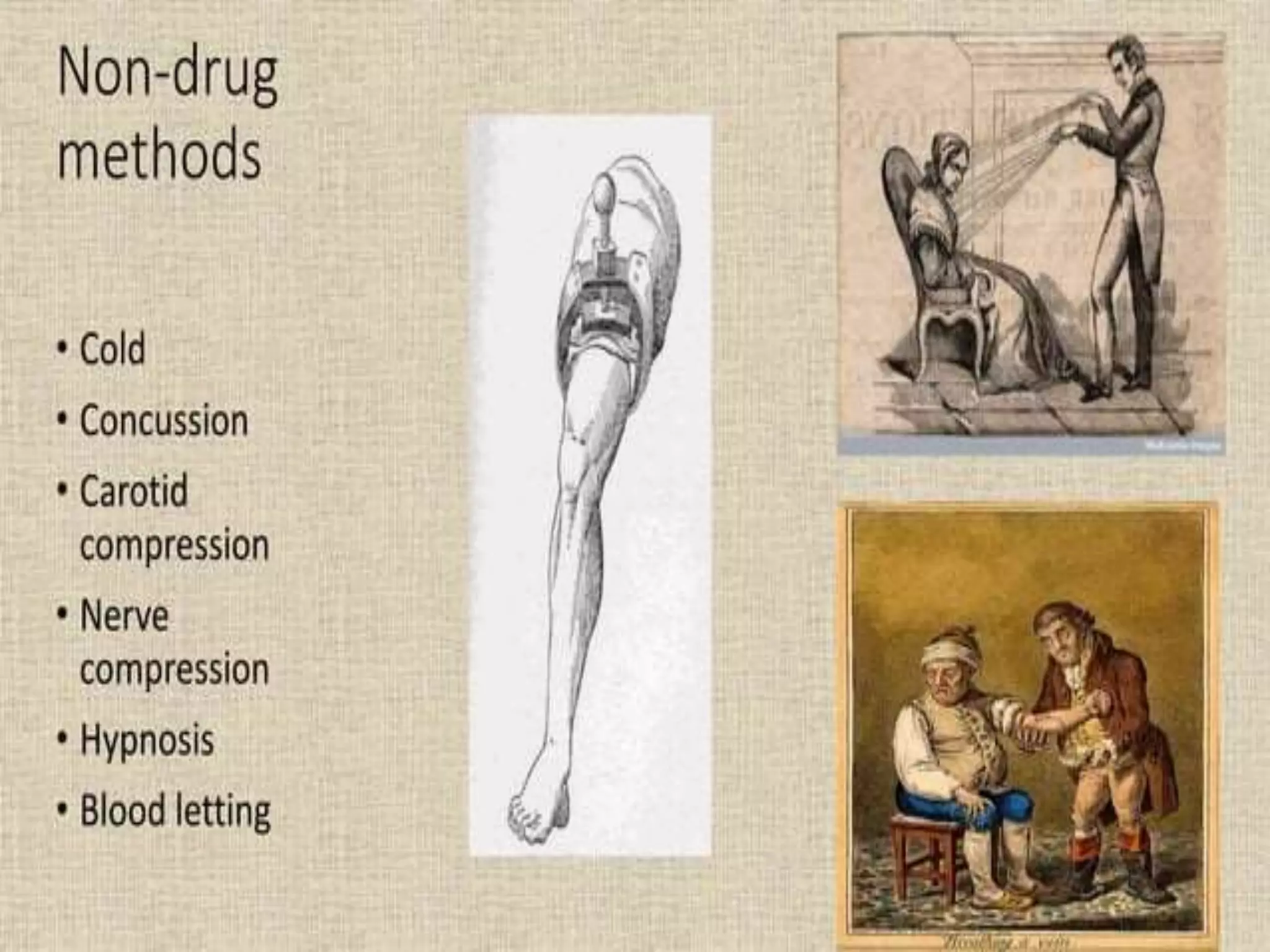 History of Anaesthesia.pptx