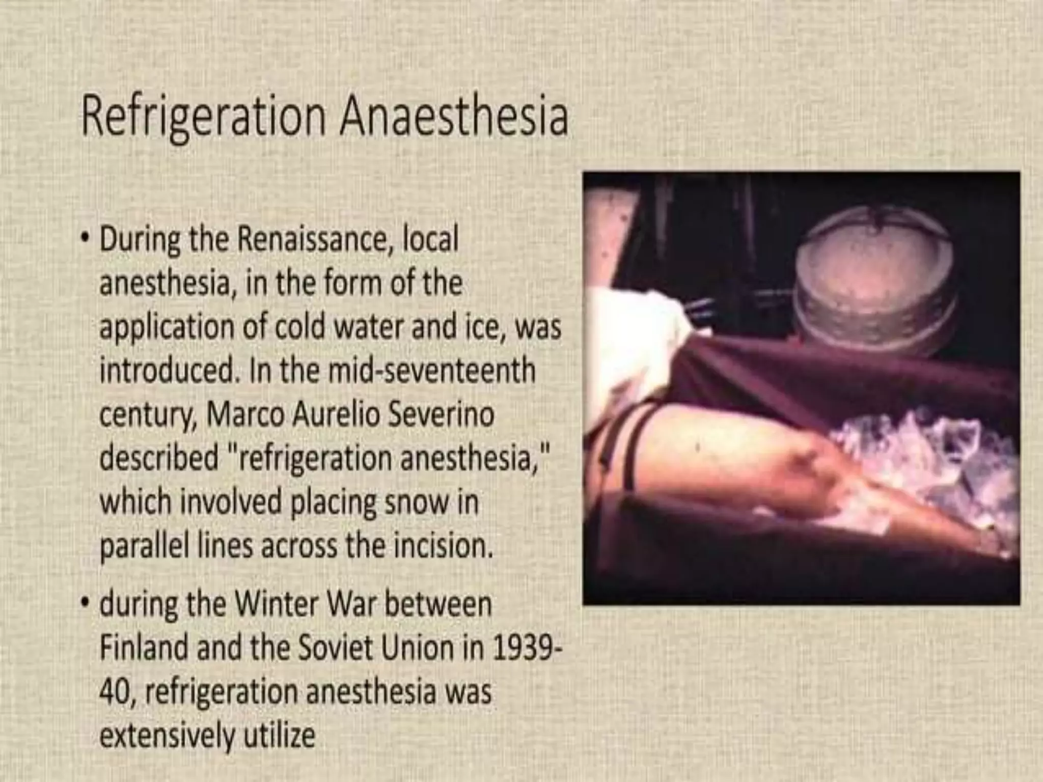 History of Anaesthesia.pptx
