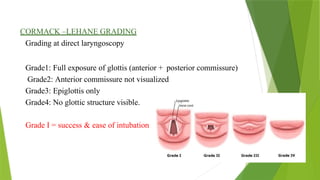 HISTORY OF ANAESTHESIAANATOMY OF AIRWAY BASICS OF GENERAL ANESTHESIA .pptx
