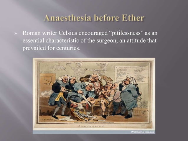 History of anaesthesia and ether dome.pptx