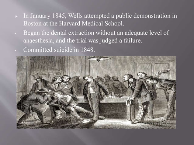 History of anaesthesia and ether dome.pptx