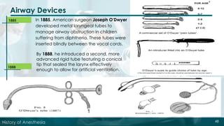 Comprehensive History and Evolution of Anesthesia Practices and Drugs ...