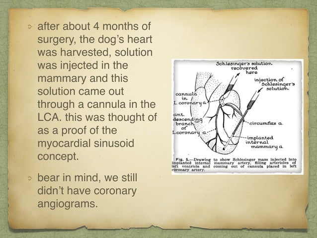 A brief History of Coronary Artery Bypass Grafting (CABG) | PDF