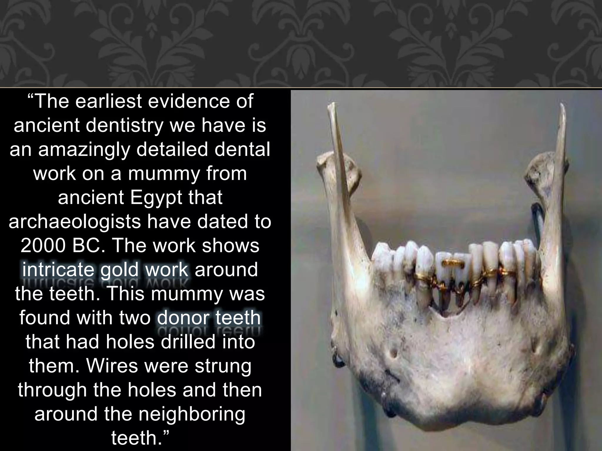 History Of Dentistry | PPTX