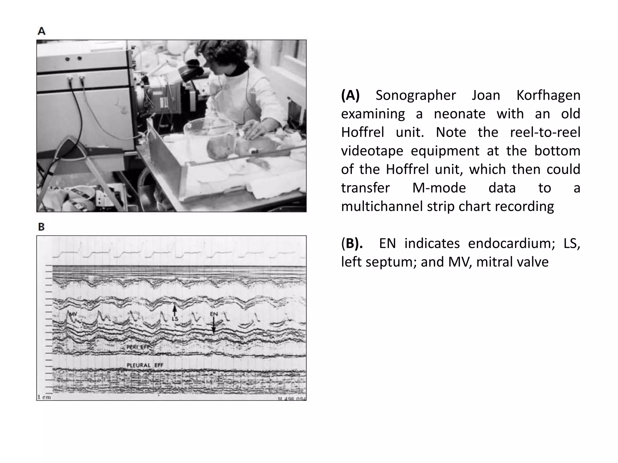 History of echocardiography | PPTX