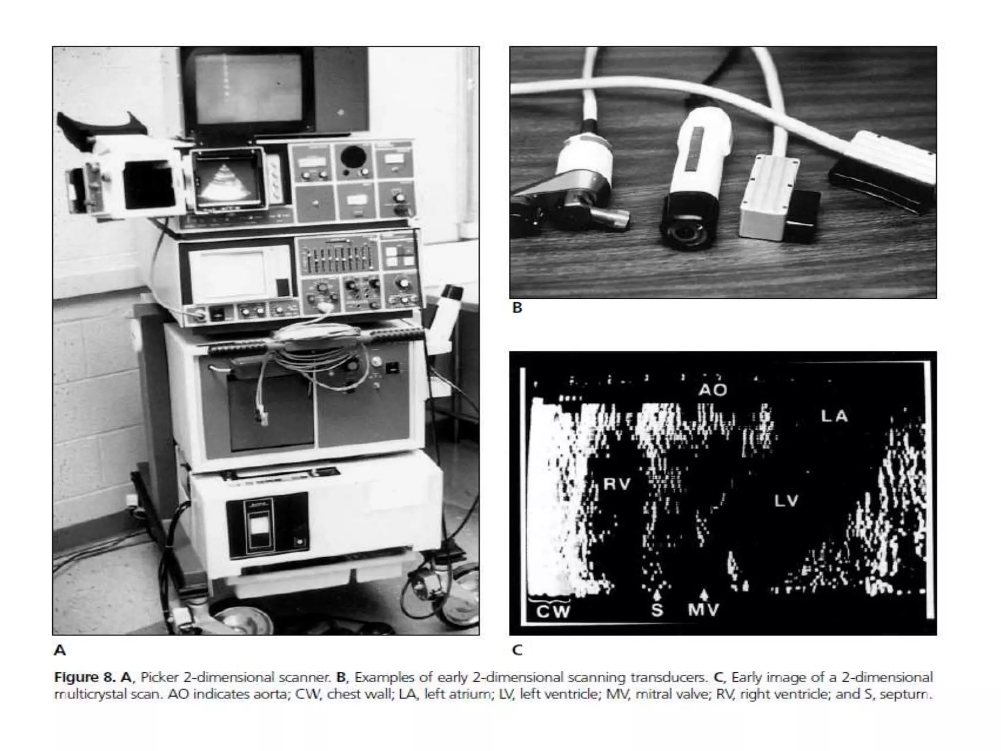 History of echocardiography | PPTX