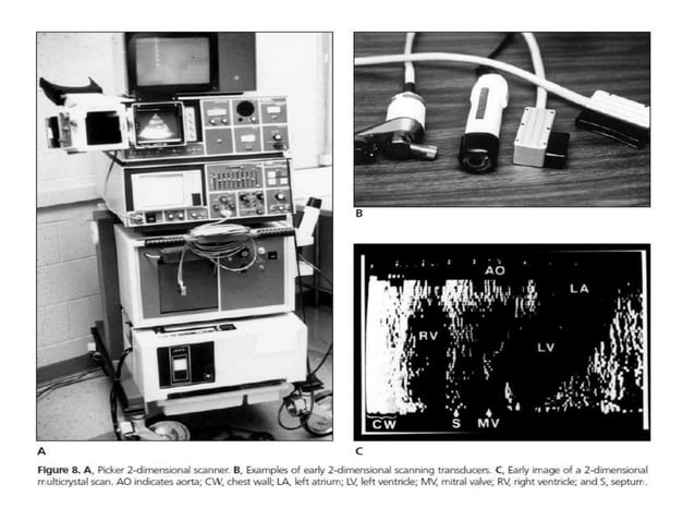 History of echocardiography